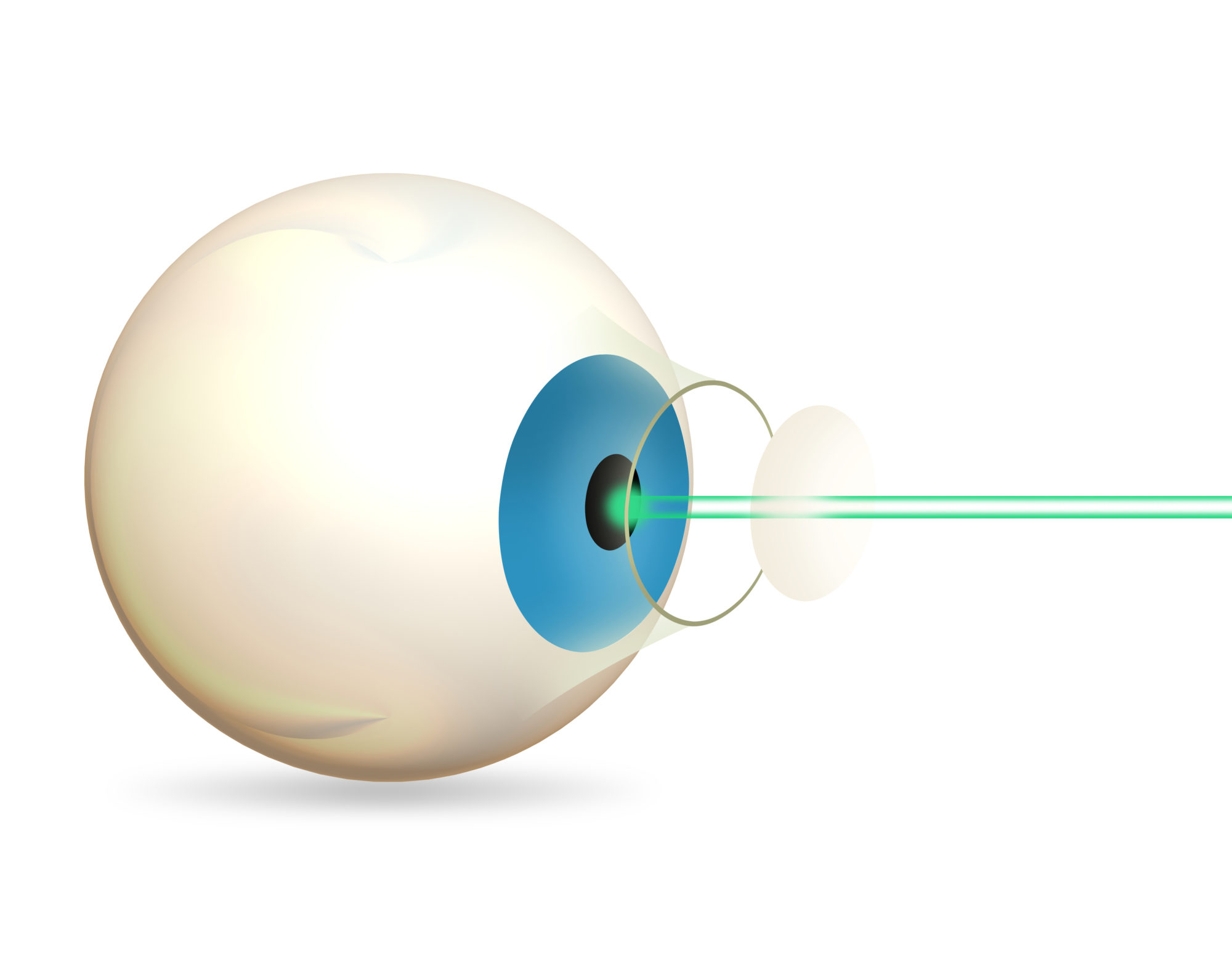 Treatments for Retina Vitreous Problems - Retina Vitreous Consultants, Inc Treatments for Retina Vitreous Problems - Retina Vitreous Consultants, Inc